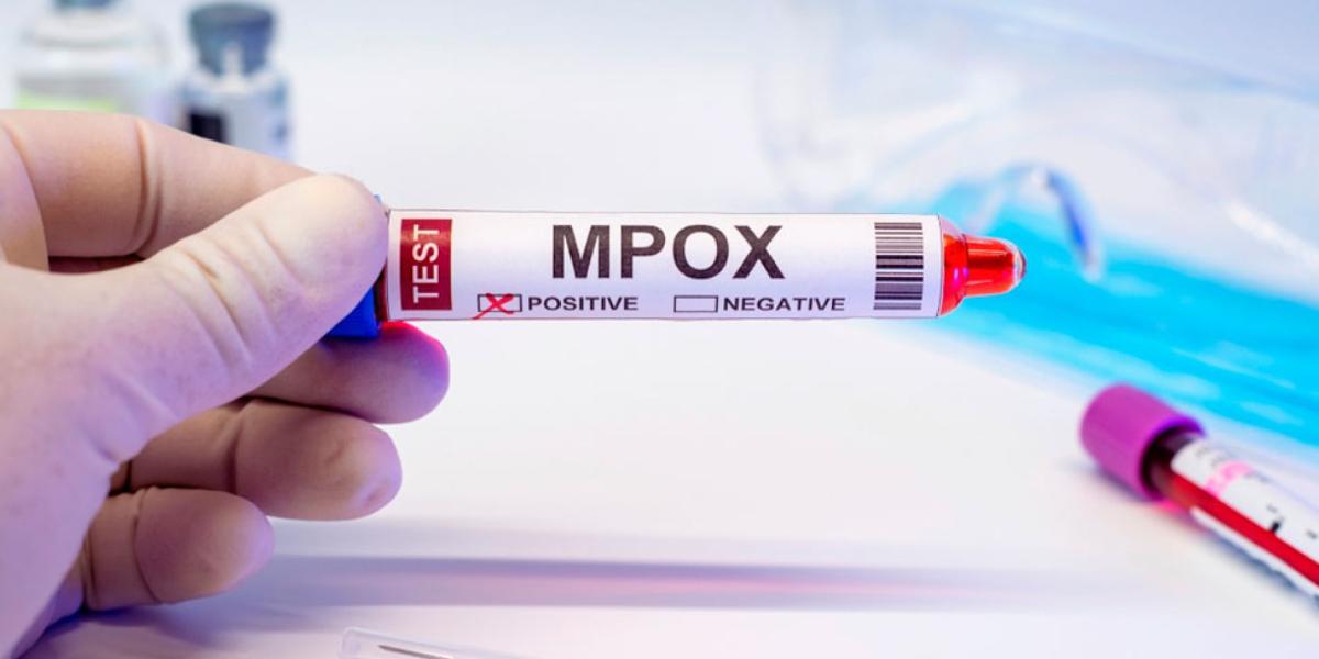 Primer caso de nueva variante de mpox en Reino Unido, según autoridades ...