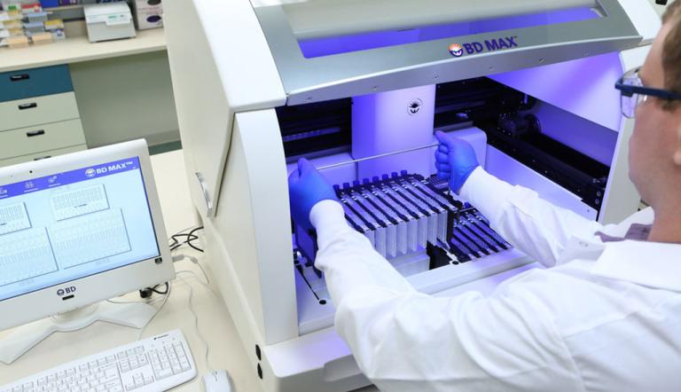 El INER avanza en detección de la tuberculosis